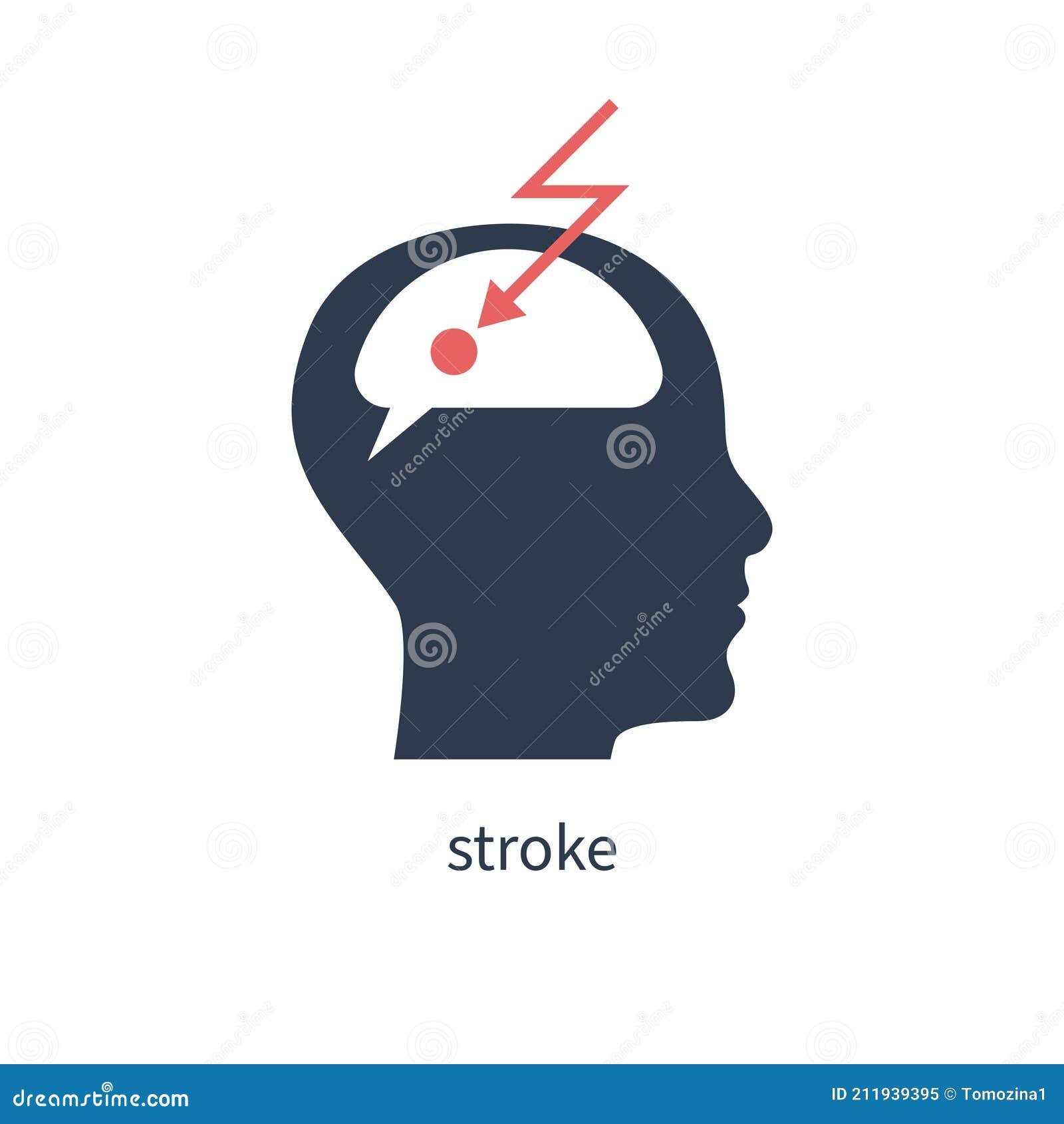 Ischemic Stroke Can Separate A Person From The World And Lock In An ...