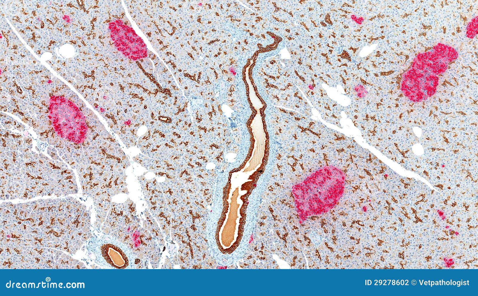 Islets of Langerhans Stained Red for Insulin Stock Photo - Image of ...