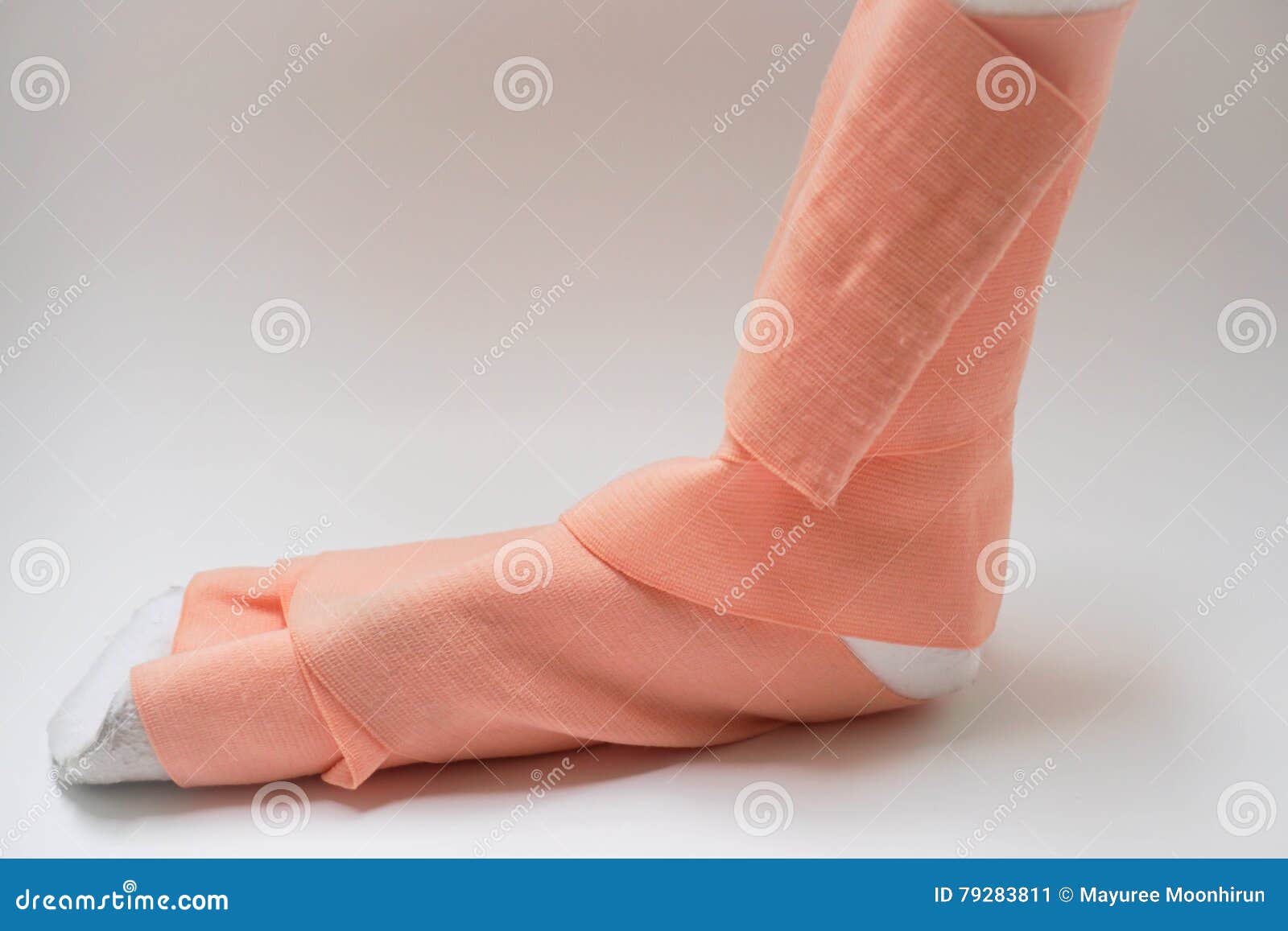 Isolate White Leg Splint Wrapped with Bandage Stock Image - Image of ...