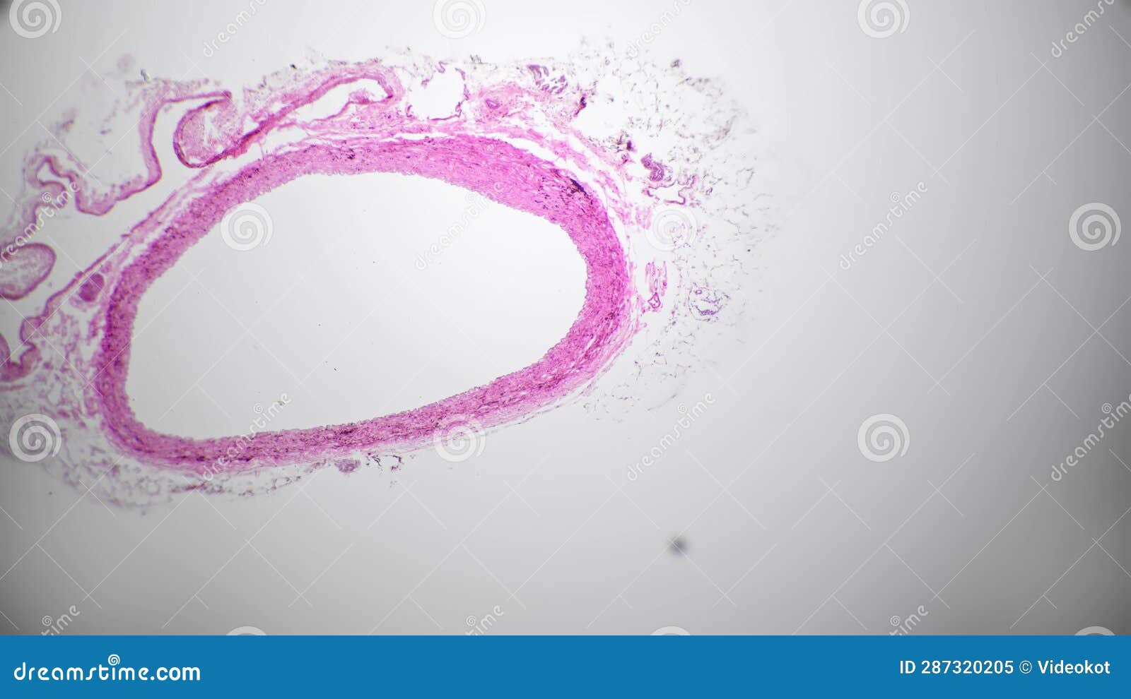 Isolated Macro Footage Of Human Vein In Section Magnified Under Microscope 40x Stock Video
