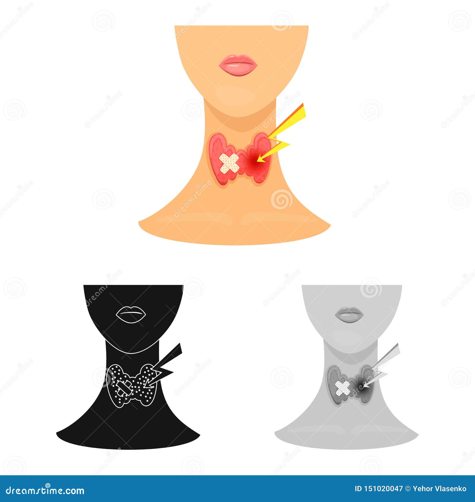 Vector Illustration of Endocrine and System Logo. Set of Endocrine and ...