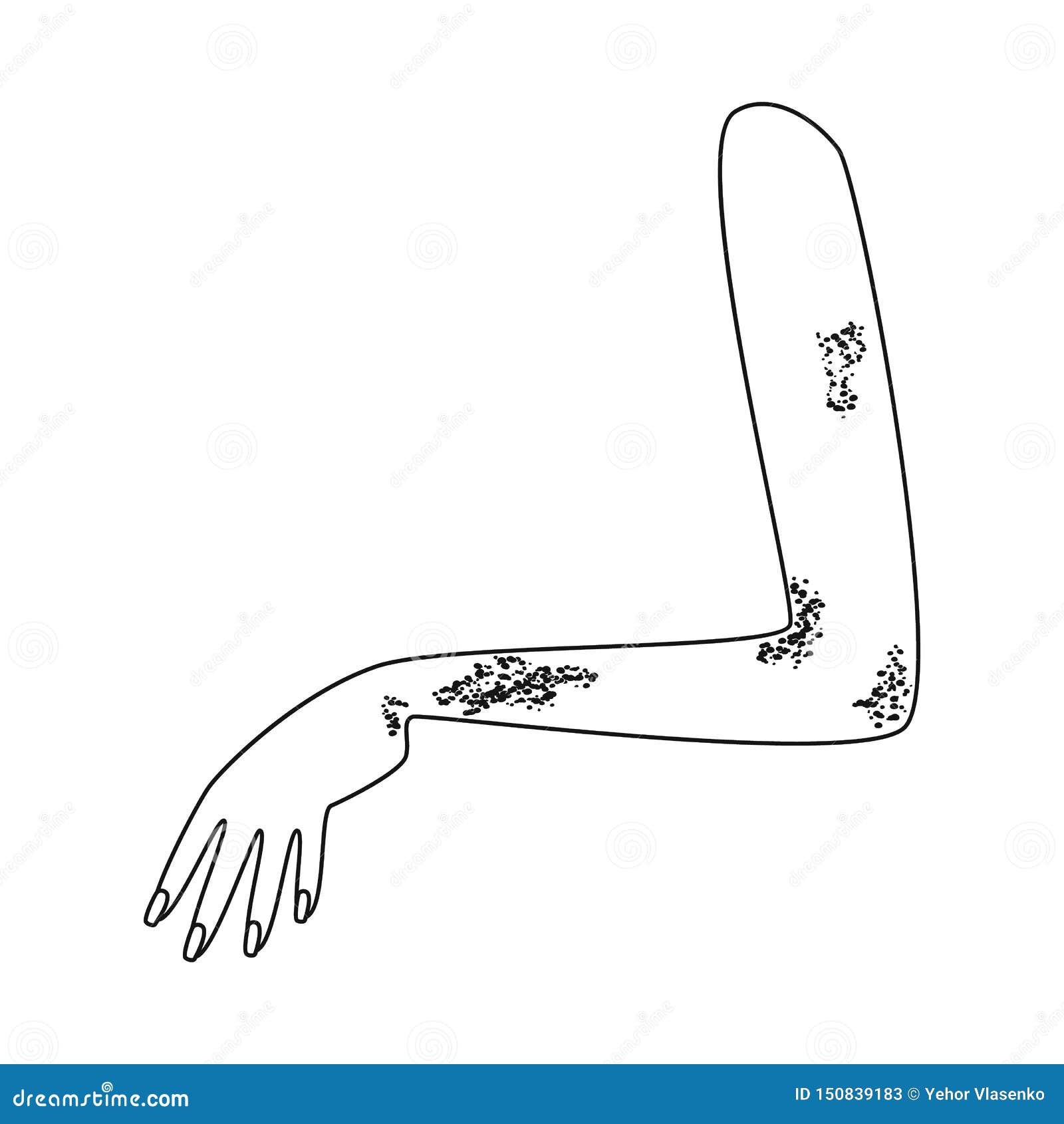 Vector Illustration Of Psoriasis And Dermatitis Sign Collection Of