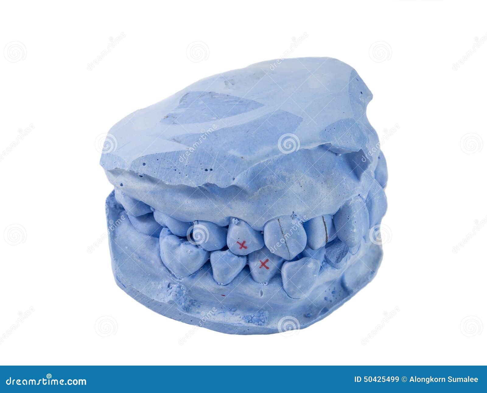 Isolated Teeth Retainer In Red Color With Plastic Box Royalty-Free ...
