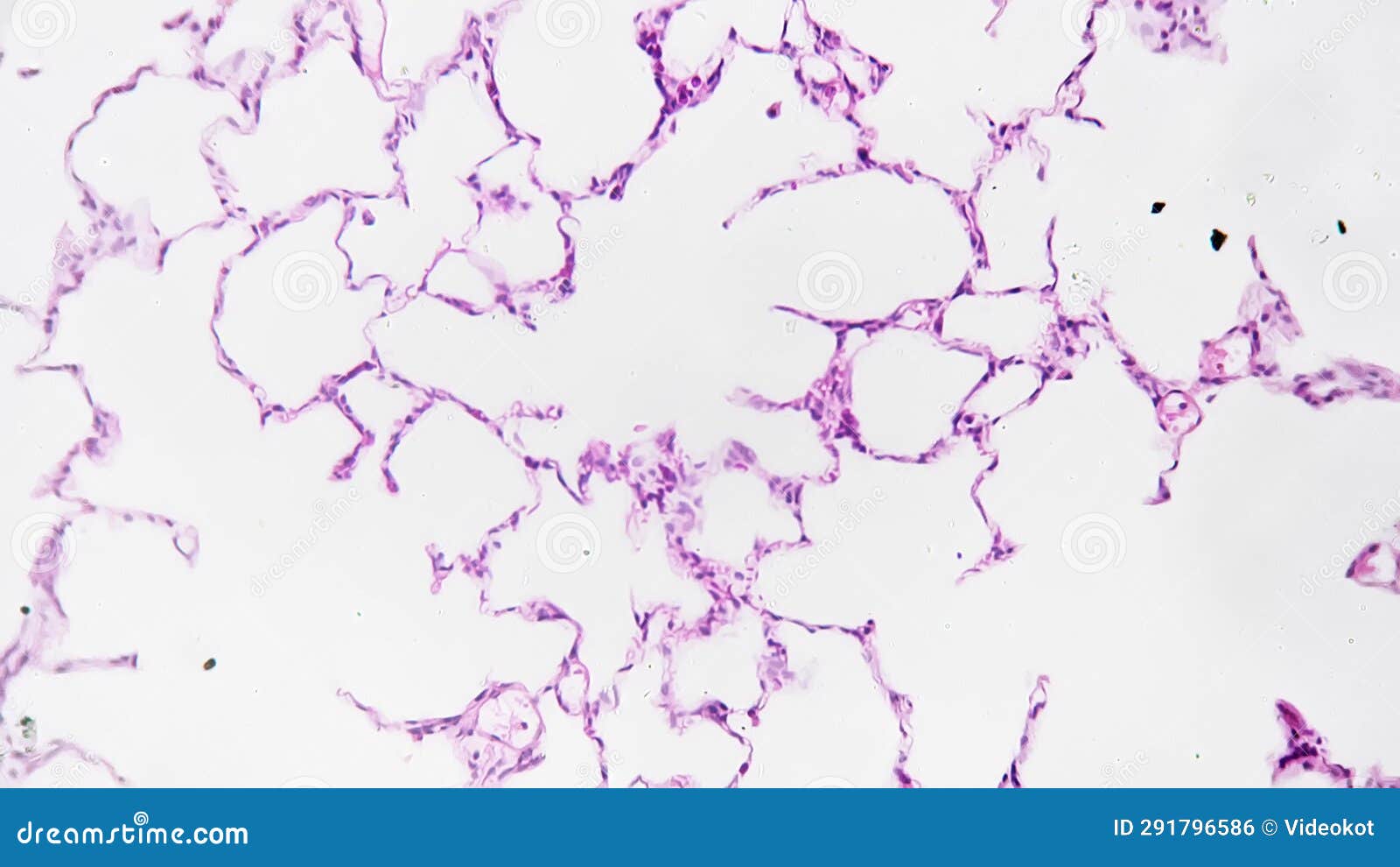 Isolated View of a Human Lung Tissue Slide is Observed Under a ...