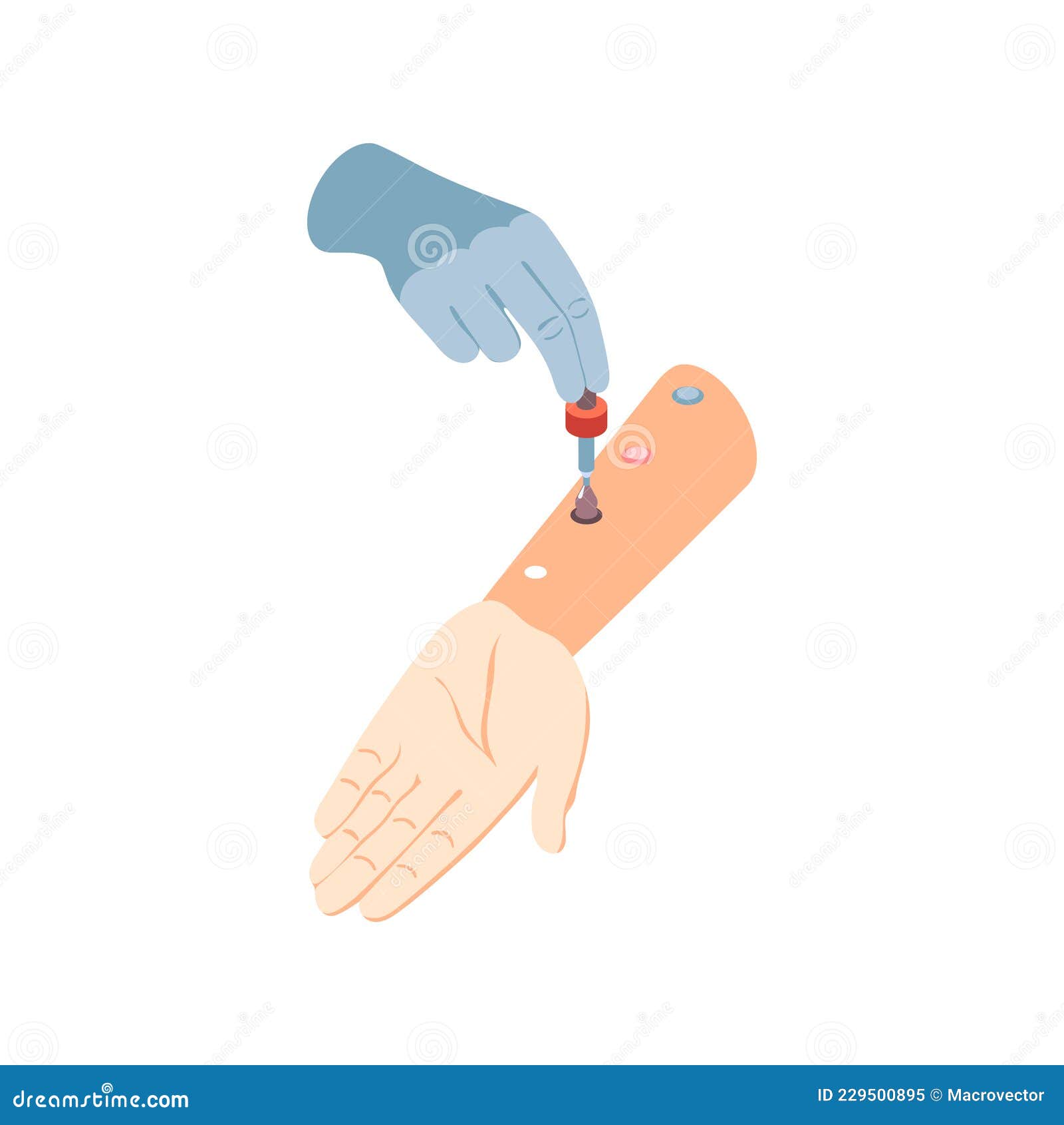 Skin Test Stock Vector Illustration Of People Arms 229500895