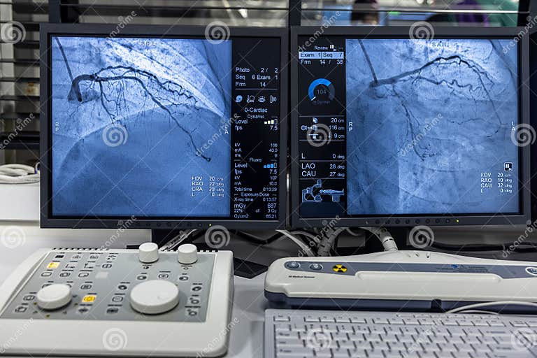 Istanbul, Turkey 28 February 2024 Angiogram Sequence Working Clockwise ...