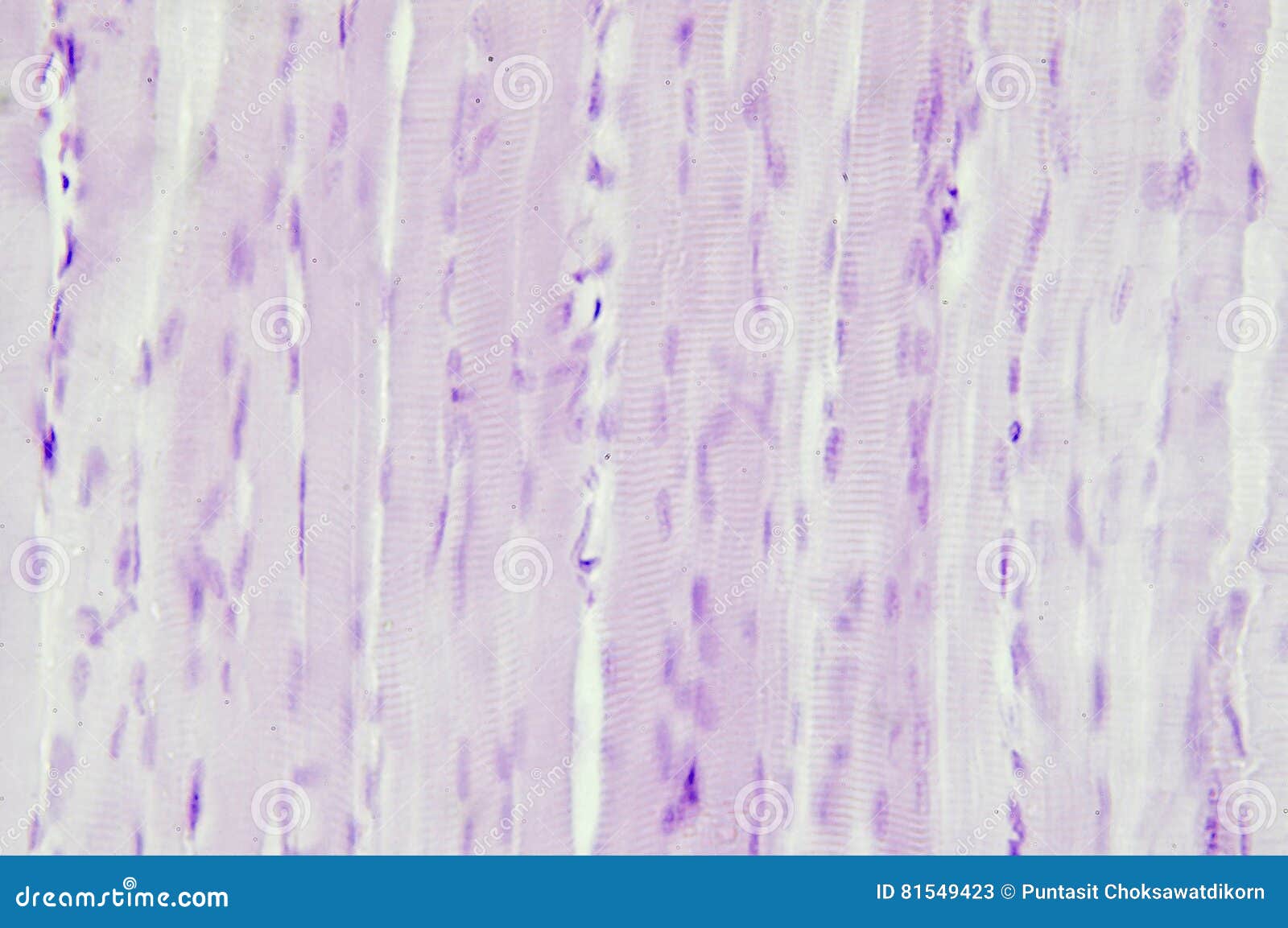 Istologia Del Muscolo Scheletrico Immagine Stock - Immagine di muscolo ...