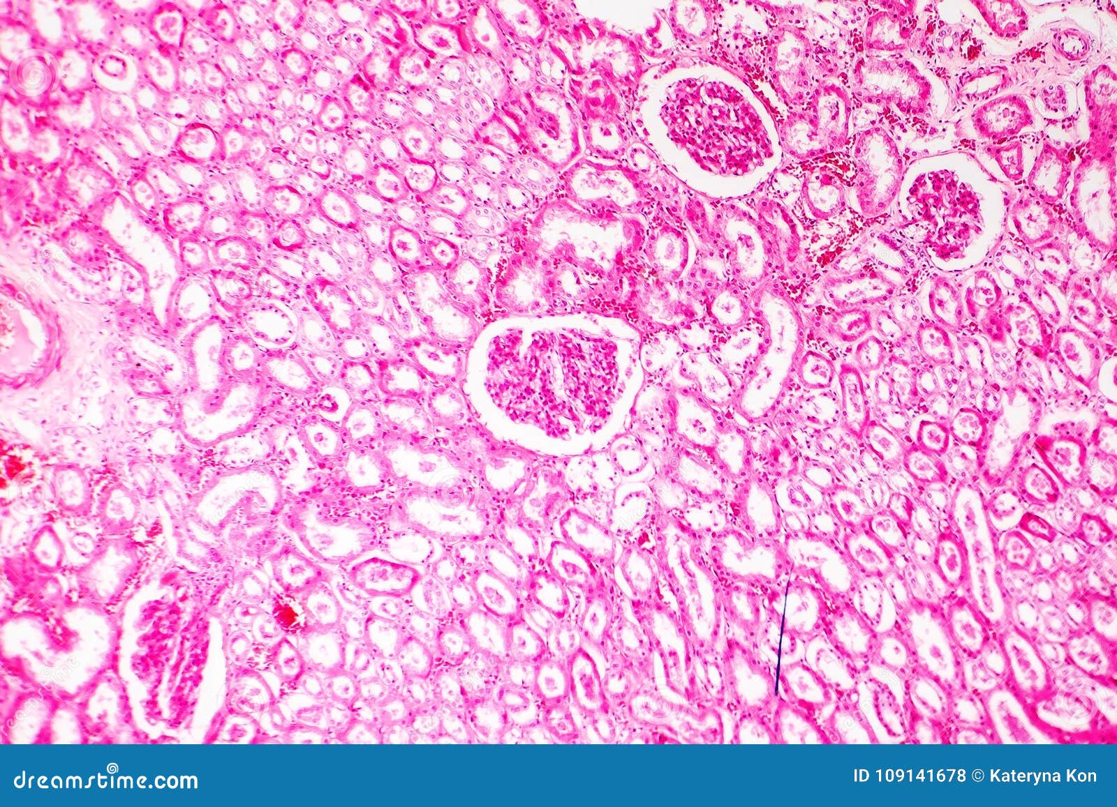Istologia del rene umano fotografia stock. Immagine di cellule - 109141678