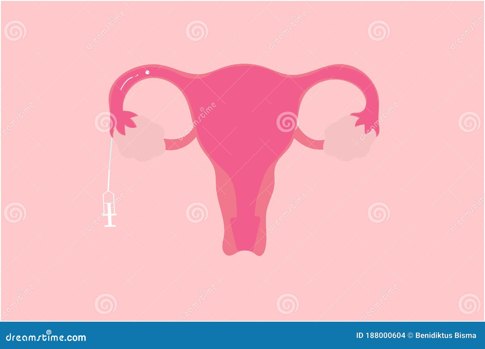 Iti Cartoons, Illustrations & Vector Stock Images - 115 Pictures to ...