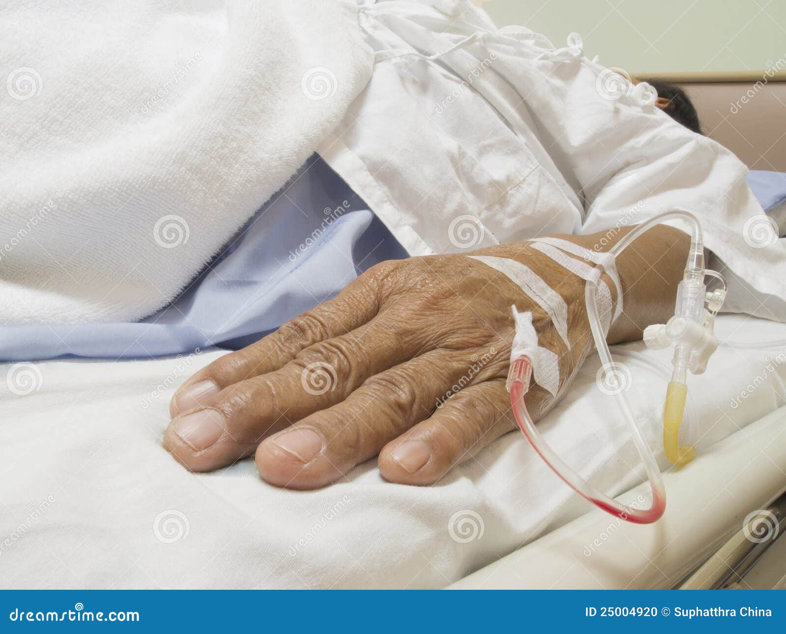IV in Arm stock photo. Image of women, replacement, injury - 25004920