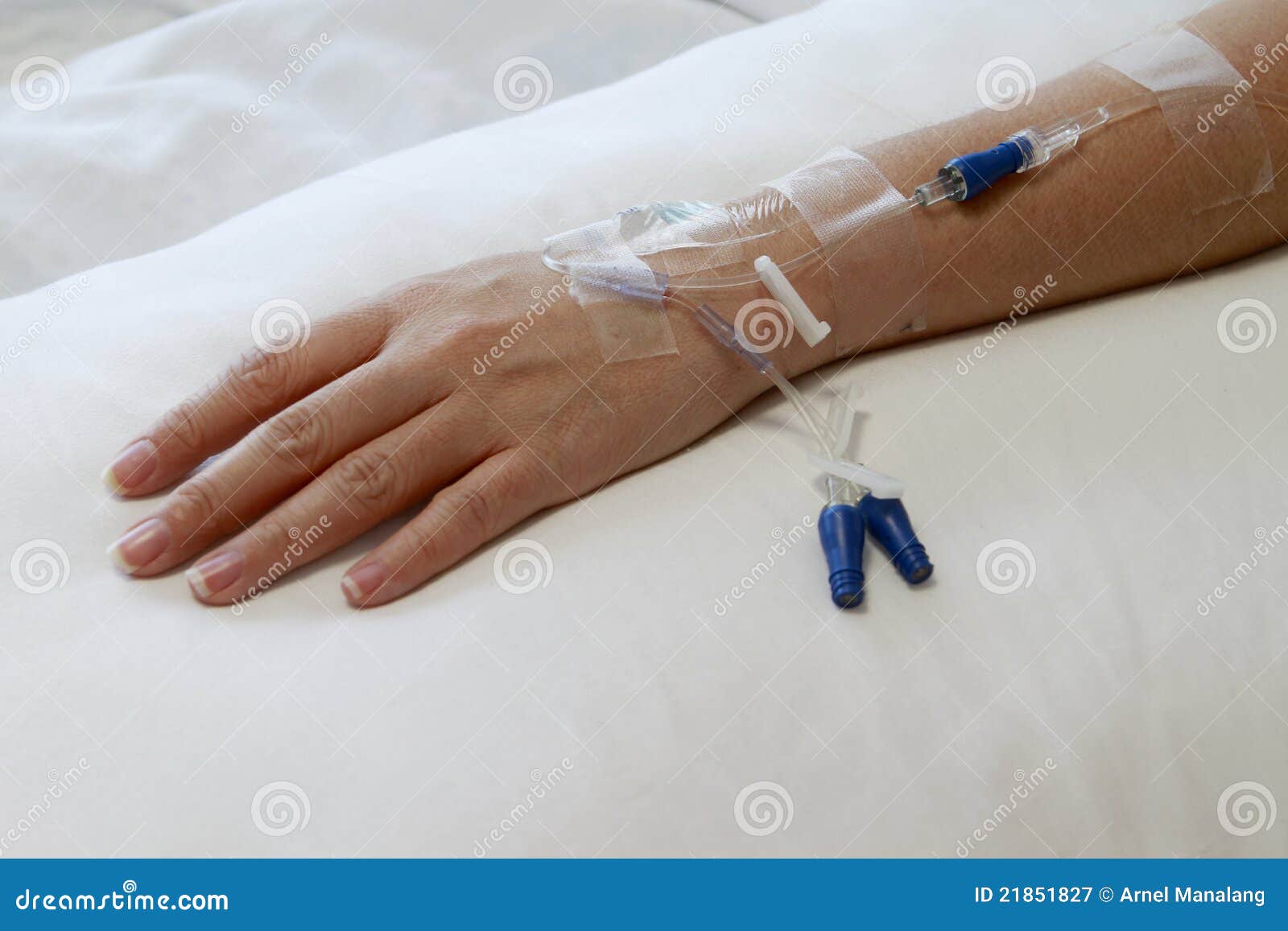 IV Drip stock image. Image of hospital, rehydrate, rehydration - 21851827