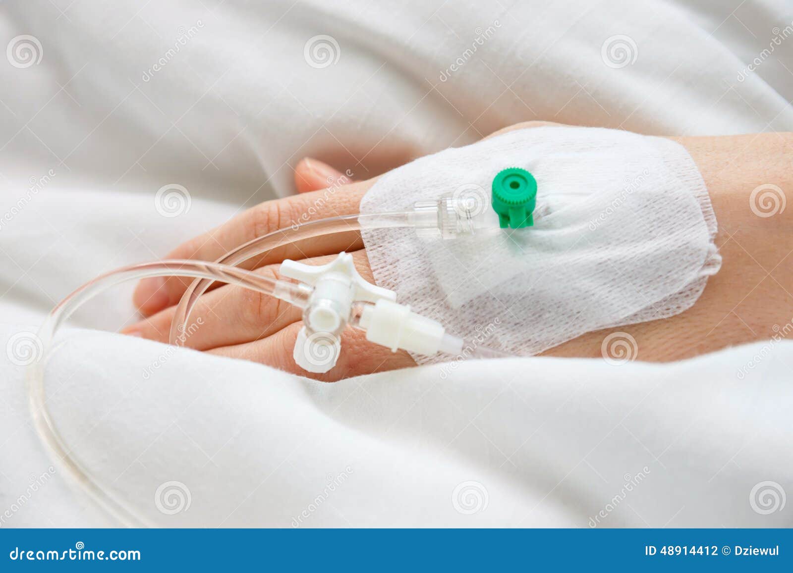 Iv drip in patient s hand stock photo. Image of health - 48914412 Iv drip in patient s hand stock photo. Image of health - 48914412