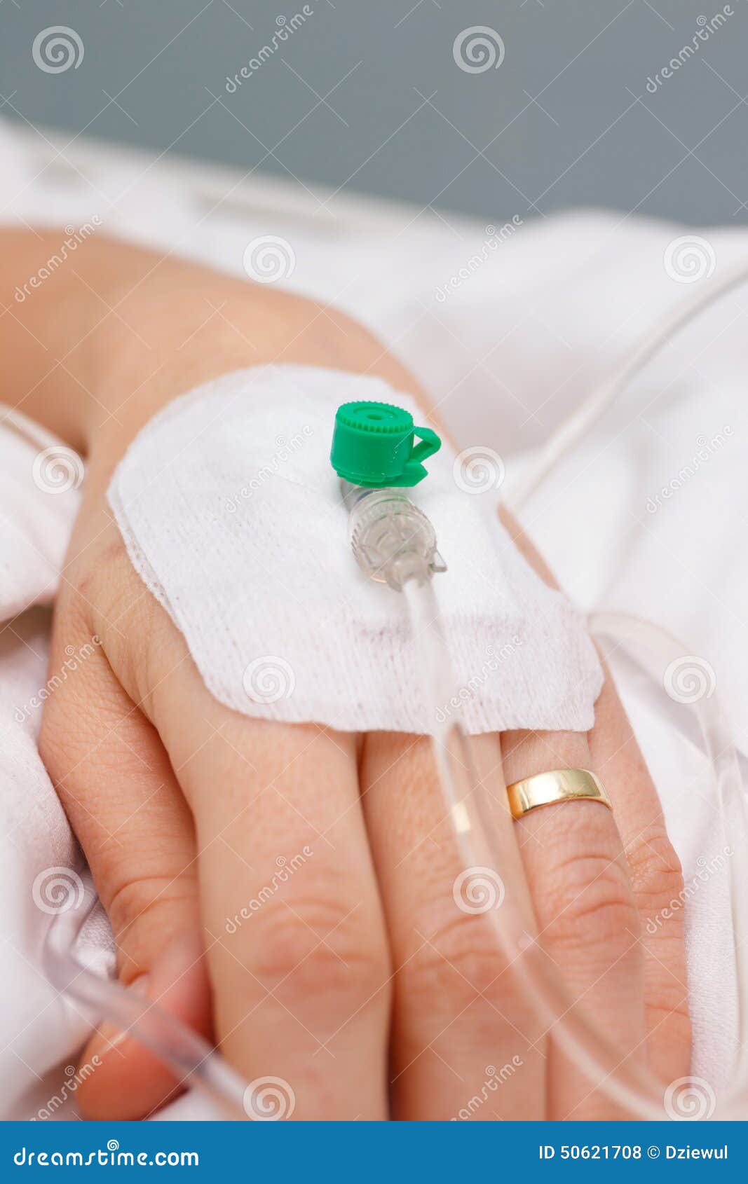 Iv drip in patient s hand stock photo. Image of life - 50621708 Iv drip in patient s hand stock photo. Image of life - 50621708