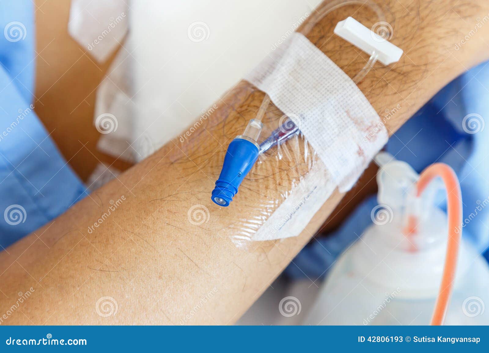 IV Needle on Patient Arm for Medicine Injection Stock Image - Image of ...