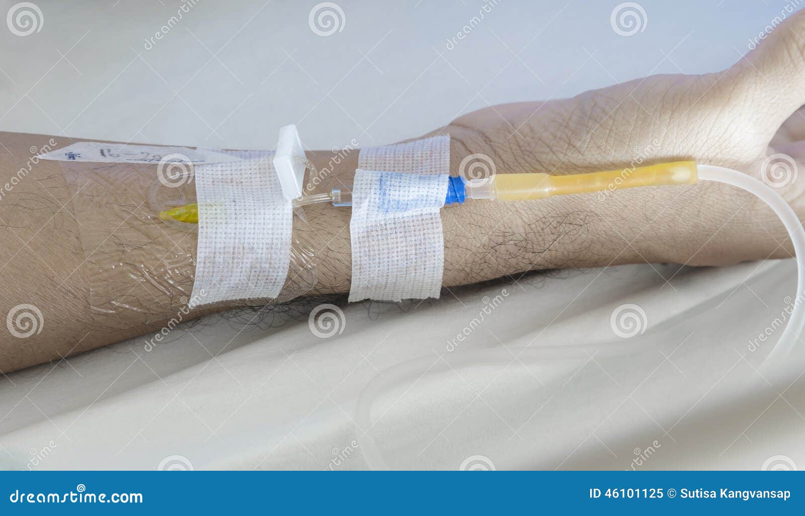 IV Needle on Patient Arm for Medicine Injection Stock Image - Image of ...