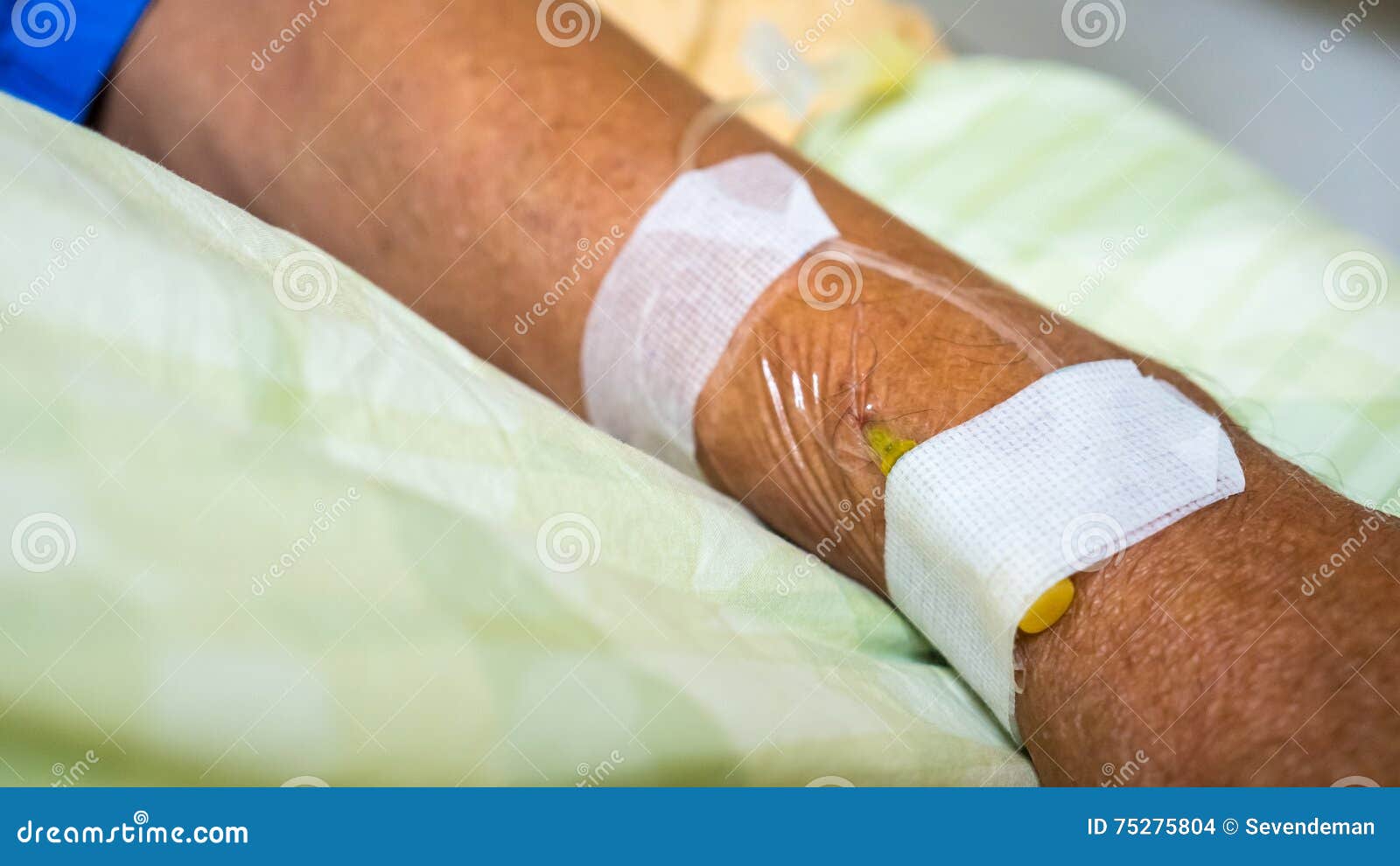 IV Needle on Patient Arm for Medicine Injection. Stock Photo - Image of ...