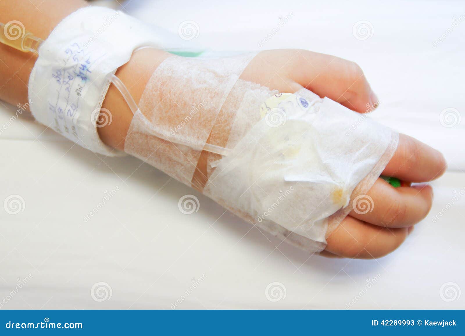 IV Solution in Baby Patient Hand Stock Image - Image of needle, healing ...