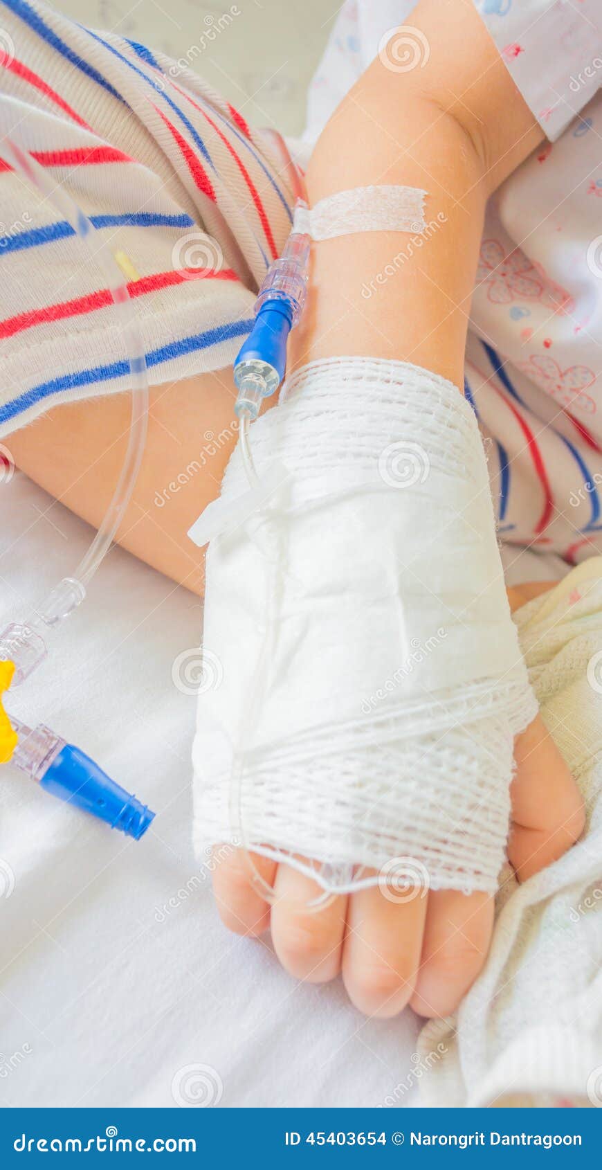 IV Solution in a Child S Patients Hand Stock Photo - Image of childhood ...