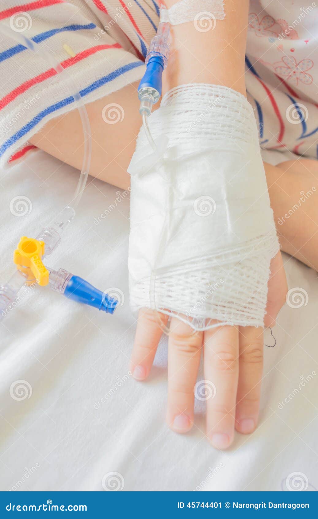 IV Solution in a Child S Patients Hand Stock Image - Image of solution ...