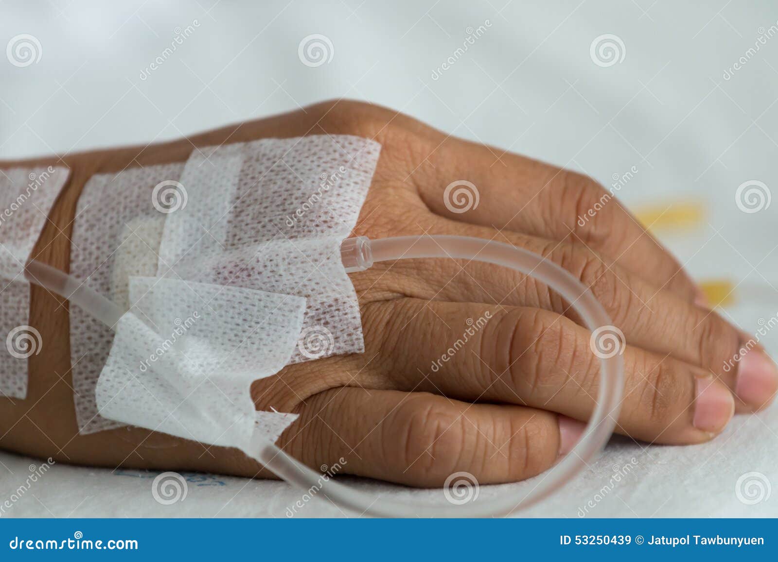 IV Solution in a Patients Hand Stock Image - Image of life, emergency ...