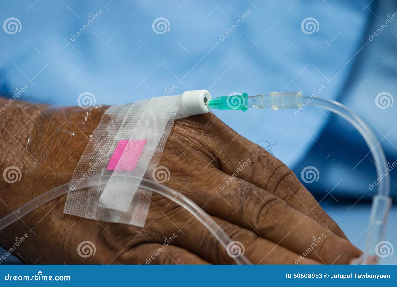IV Solution in a Patients Hand Stock Image - Image of healthy, care ...