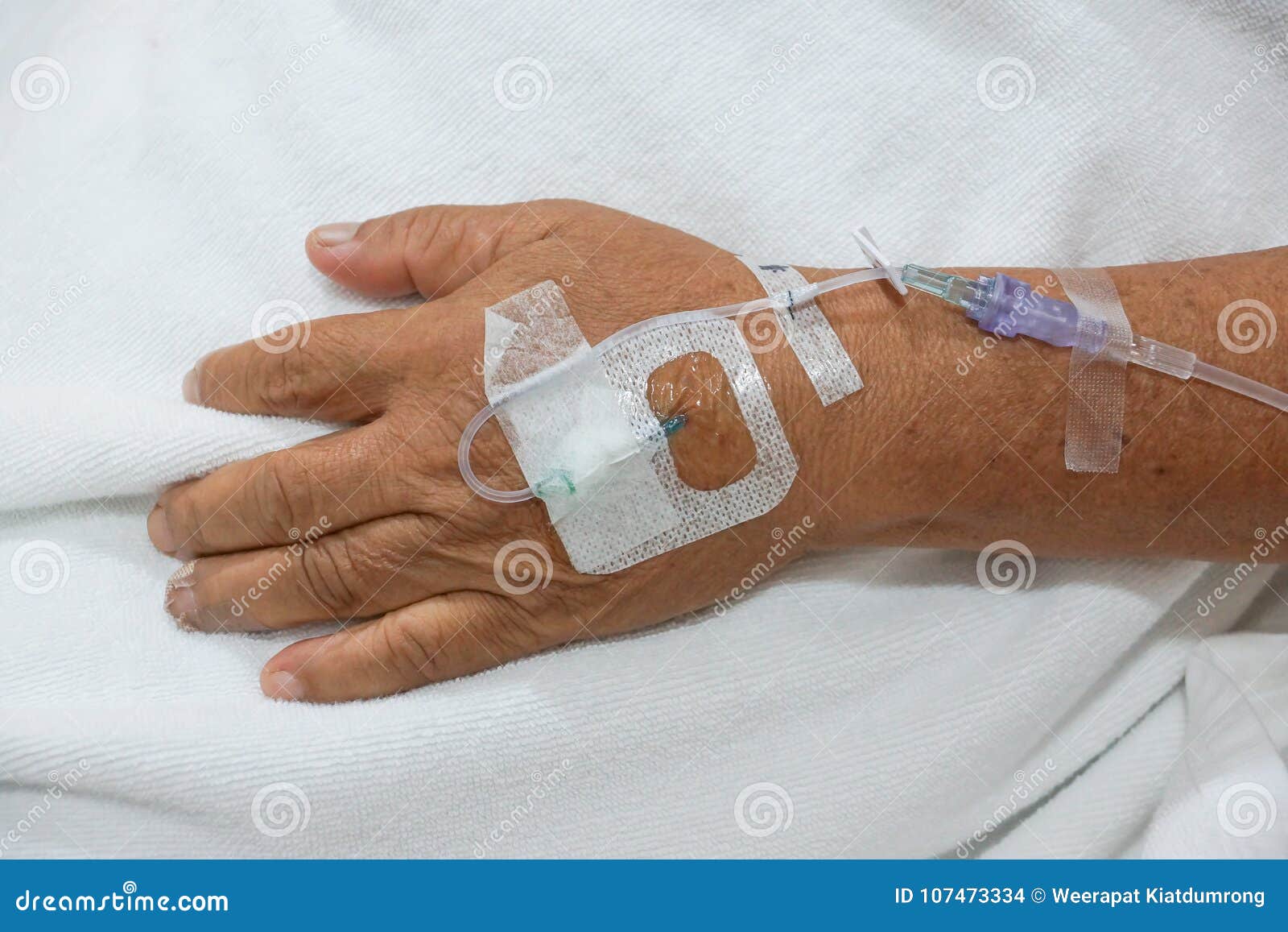 IV Solution in a Patients Hand Stock Photo - Image of care, illness ...