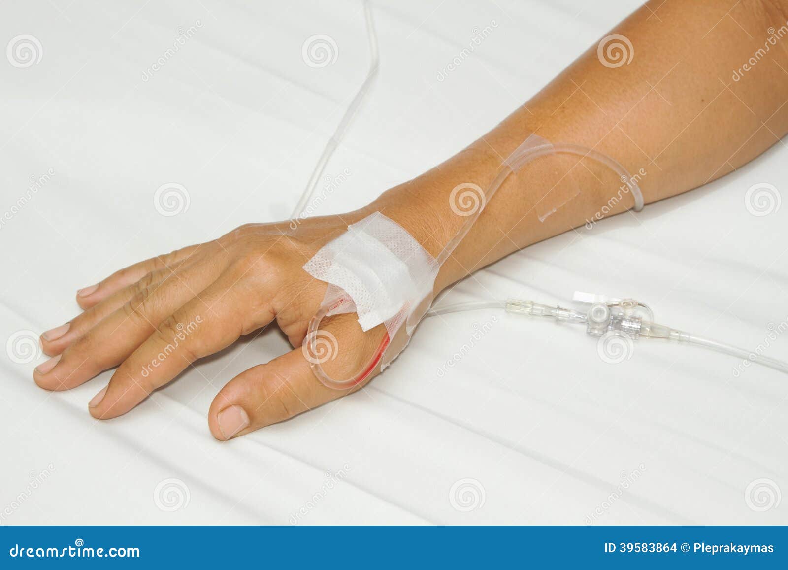 IV Solution in a Patients Hand Stock Photo - Image of drug, saline ...