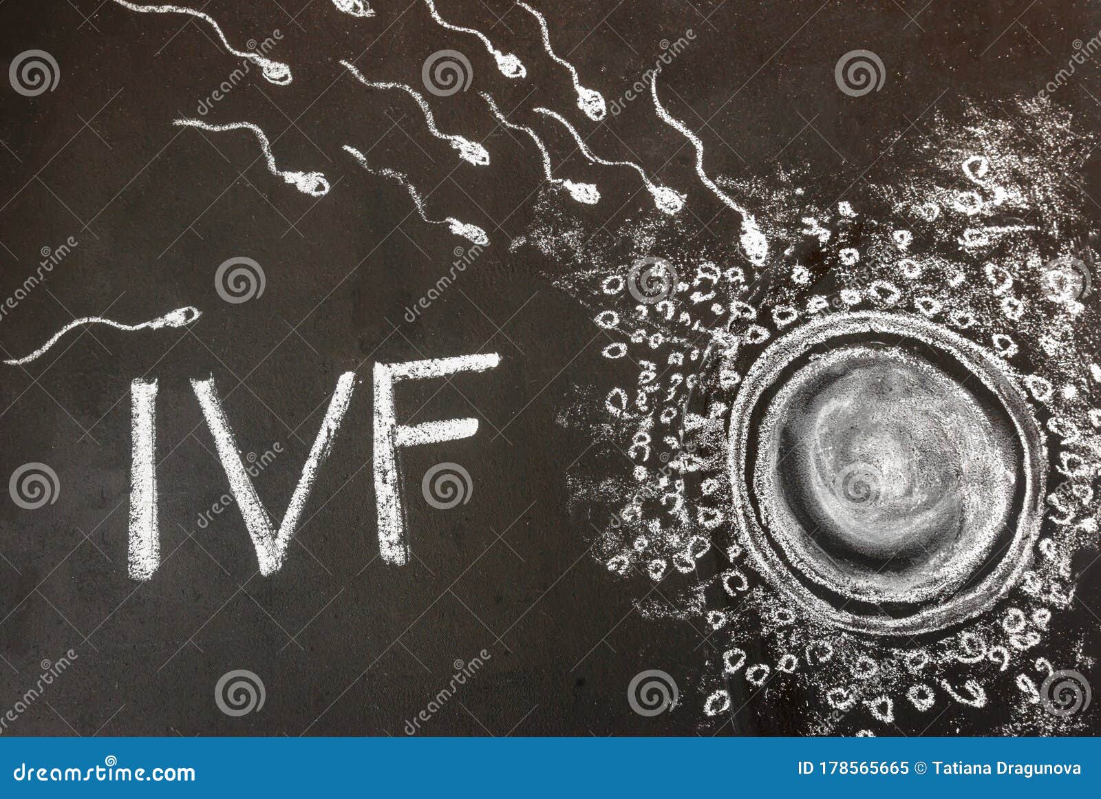 IVF Concept. Figure of Egg and Sperm on a Black Chalk Board, Drawn in ...
