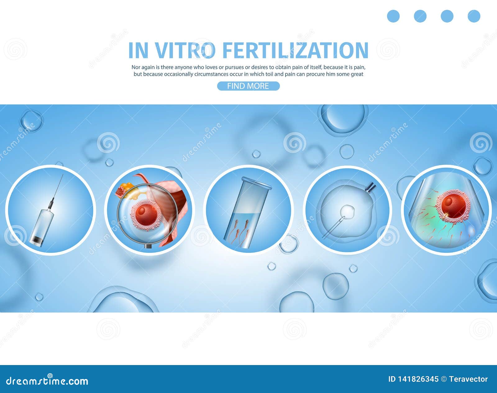 IVF Process Procedures Schematic Explanations. Stock Vector ...