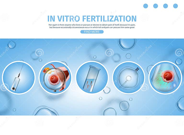 IVF Process Procedures Schematic Explanations. Stock Vector ...