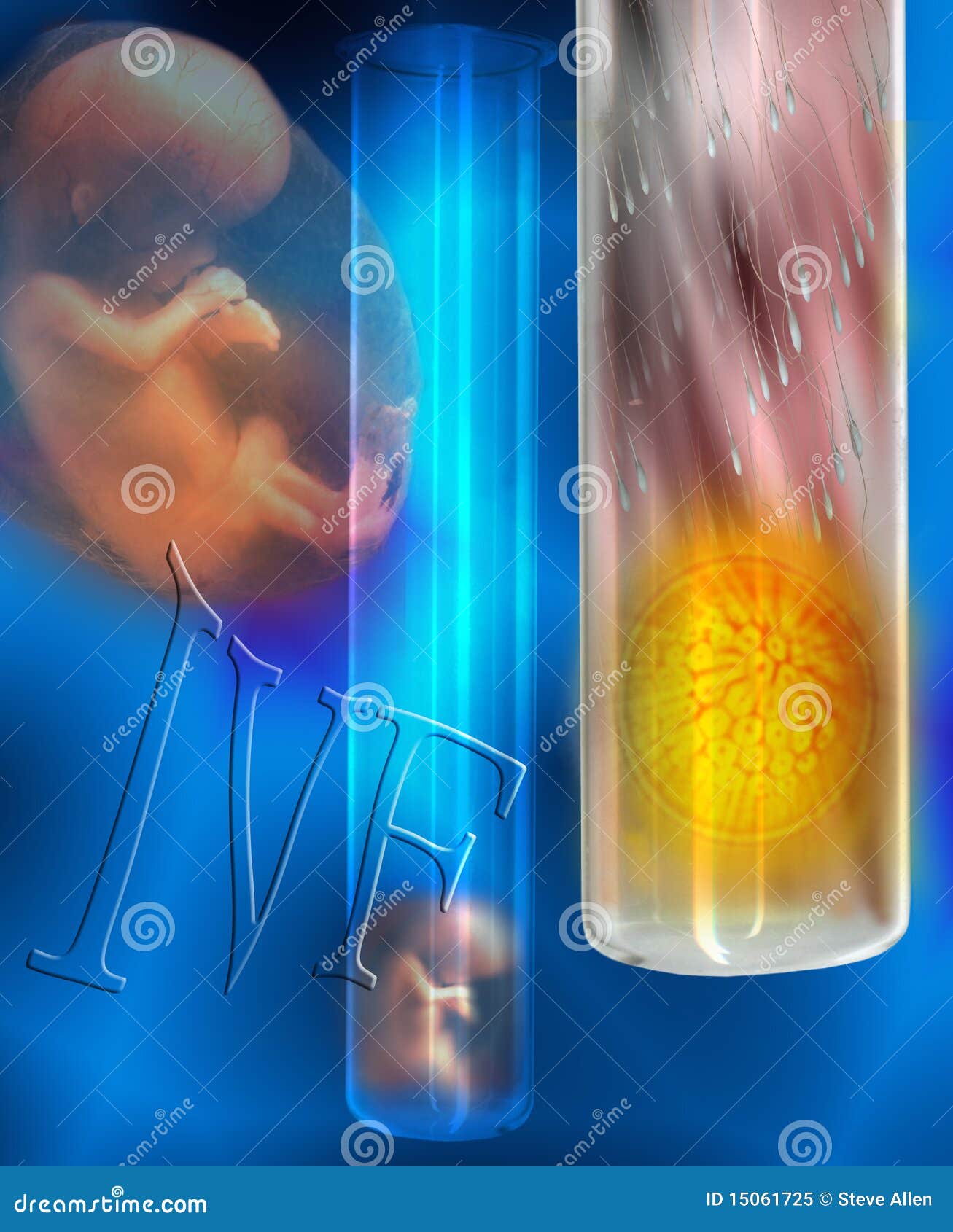 IVF - in Vitro Fertilisation Stock Illustration - Illustration of life ...