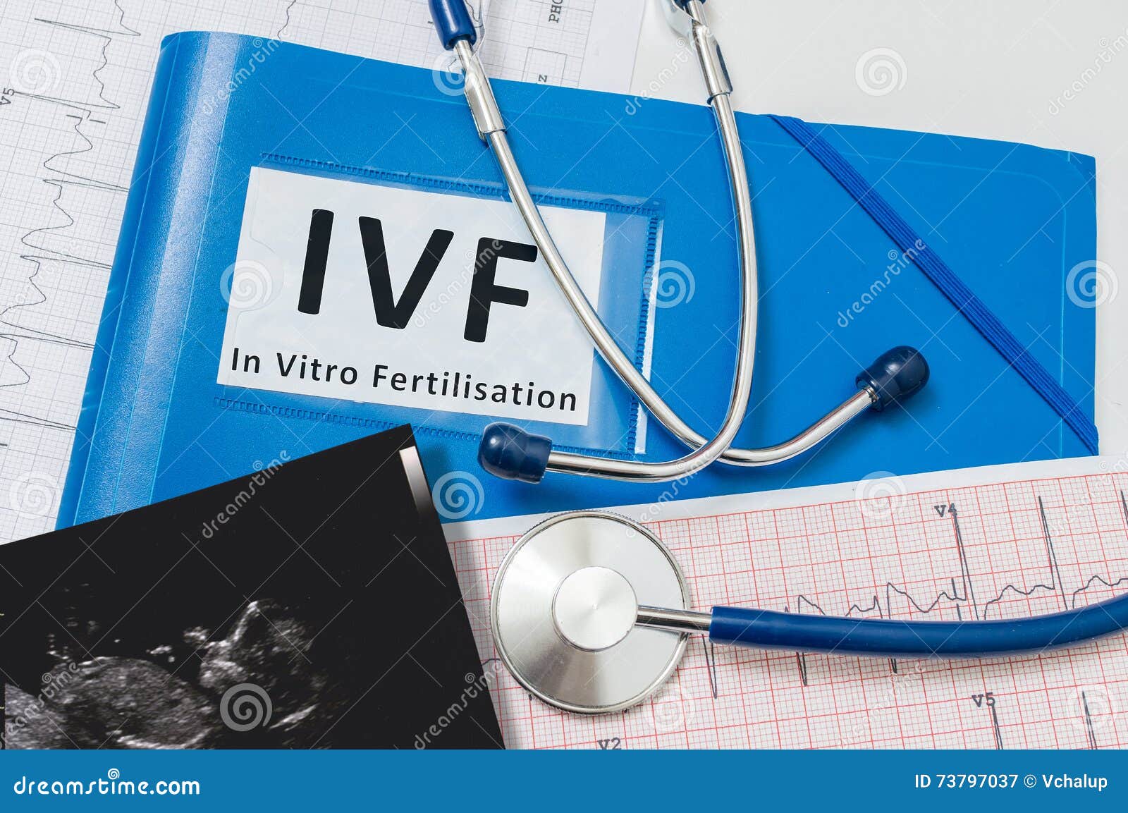IVF (in Vitro Fertilisation Concept). Blue Folder with Patient Files ...