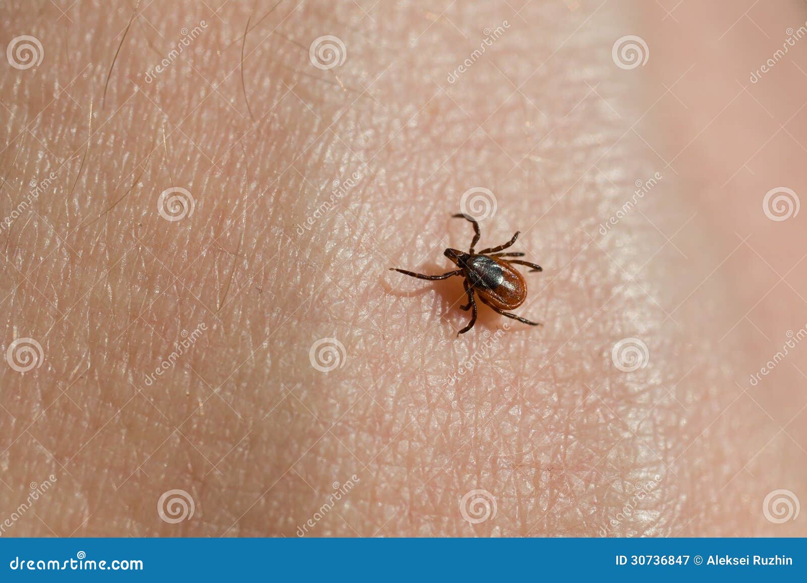Ixodes Scapularis, Black Legged Tick Or Deer Tick, Transmitter Of Lyme ...