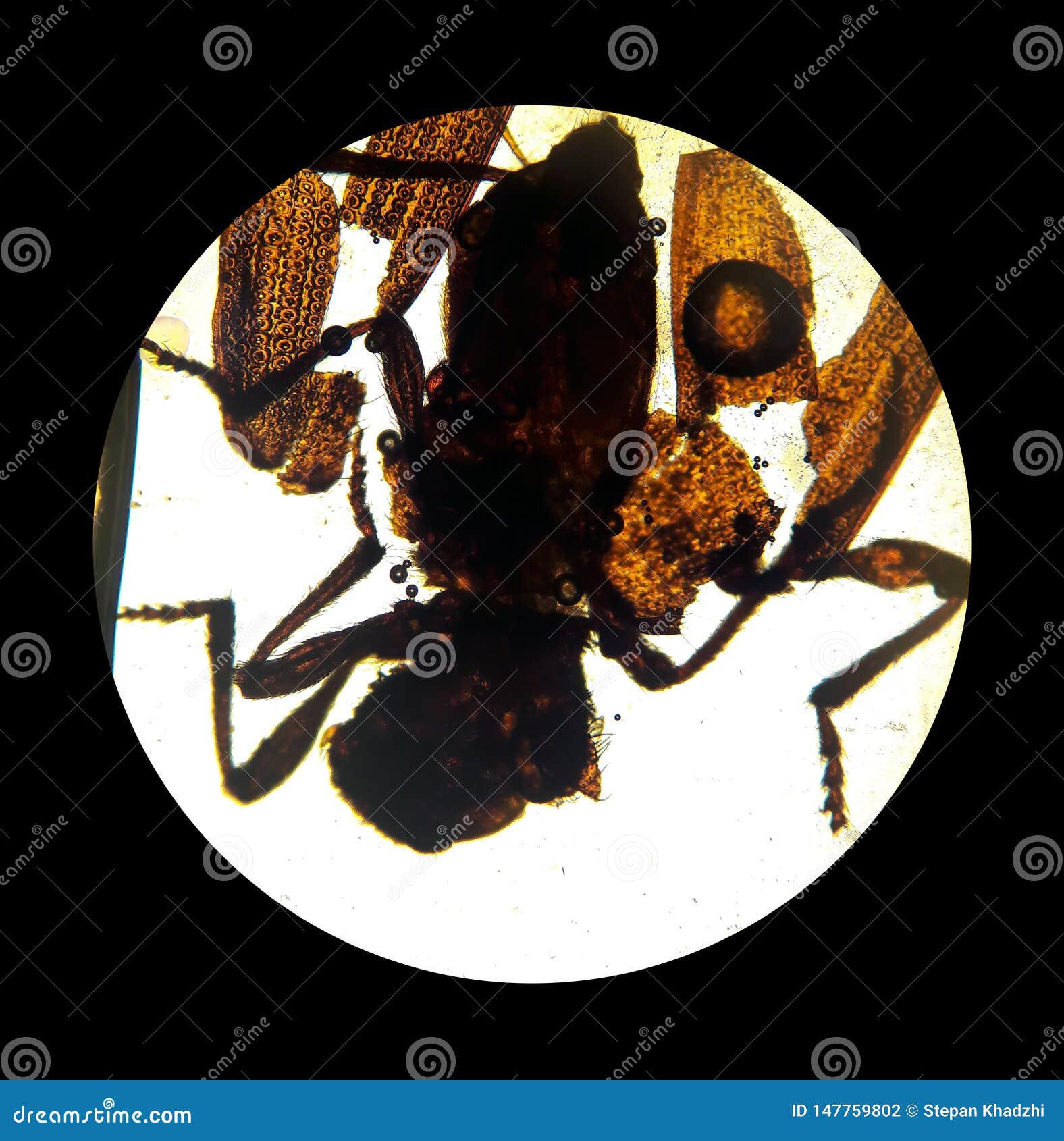 Microscope - Tick (Rhipicephalus Sanguineus) Stock Photo ...