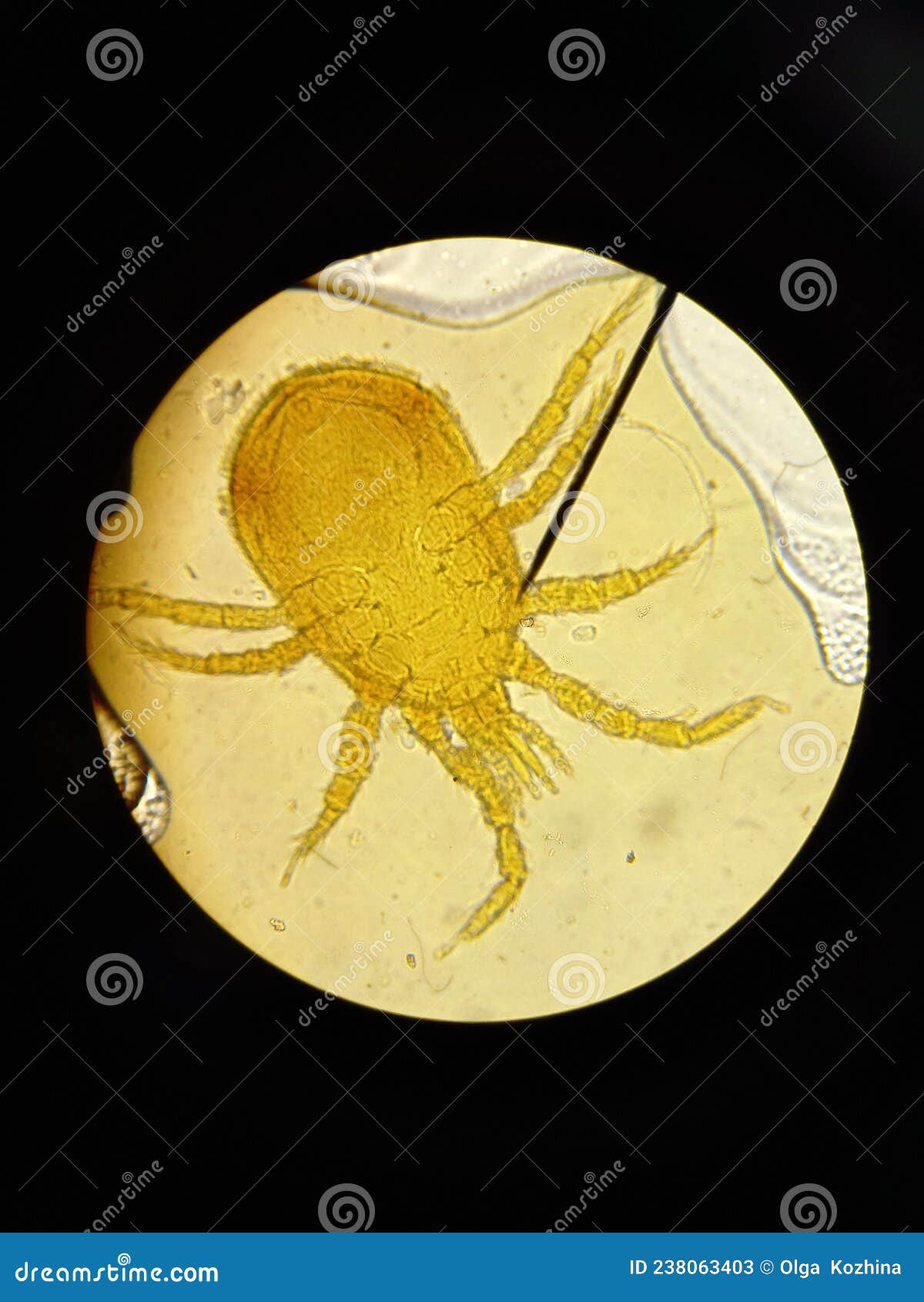 Tick Under Microscope