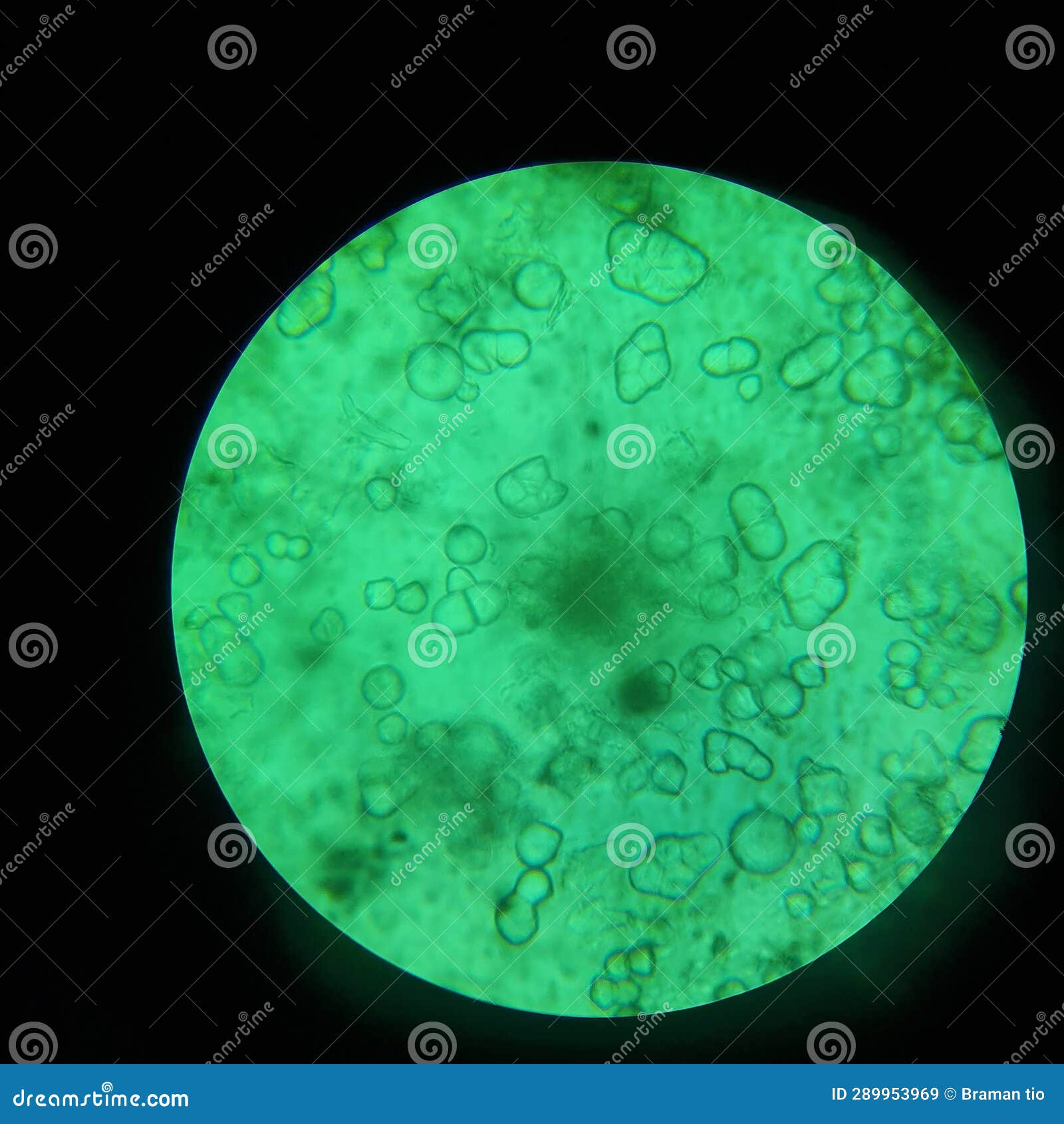 Jackfruit Seed Starch Particles Under a Microscope Stock Image - Image ...