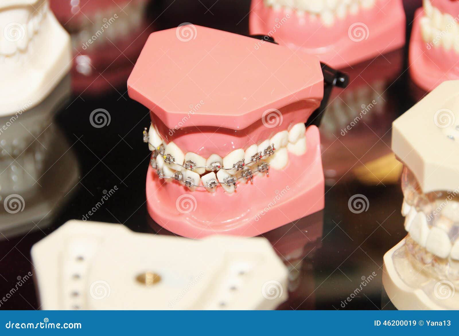 Jaw stock image. Image of medical, clinic, orthodontic - 46200019