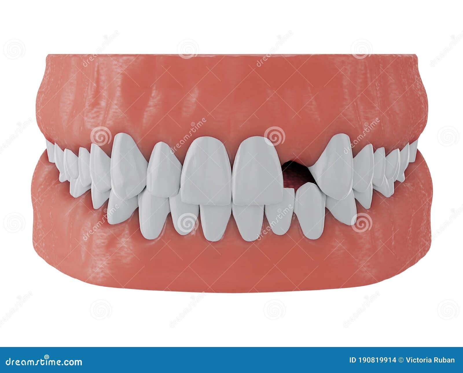 Front Tooth Cartoon Vector | CartoonDealer.com #69645937