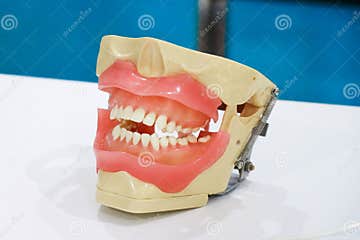 Jaw Teeth or Human Jaw Model with a View of Teeth. Prosthetic Model for ...