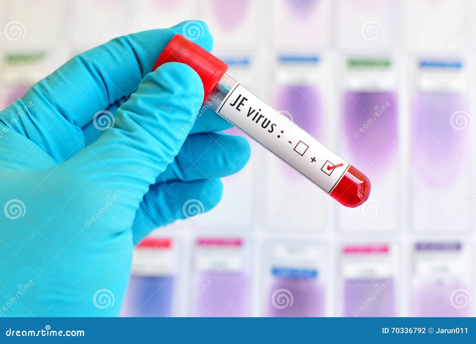 JE virus positive stock photo. Image of exam, immunology - 70336792