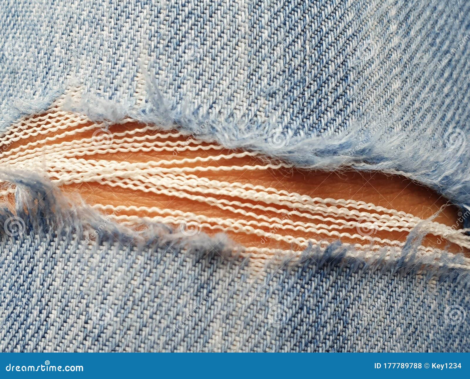 Jeans azul rasgado. foto de stock. Imagem de estilo - 177789788