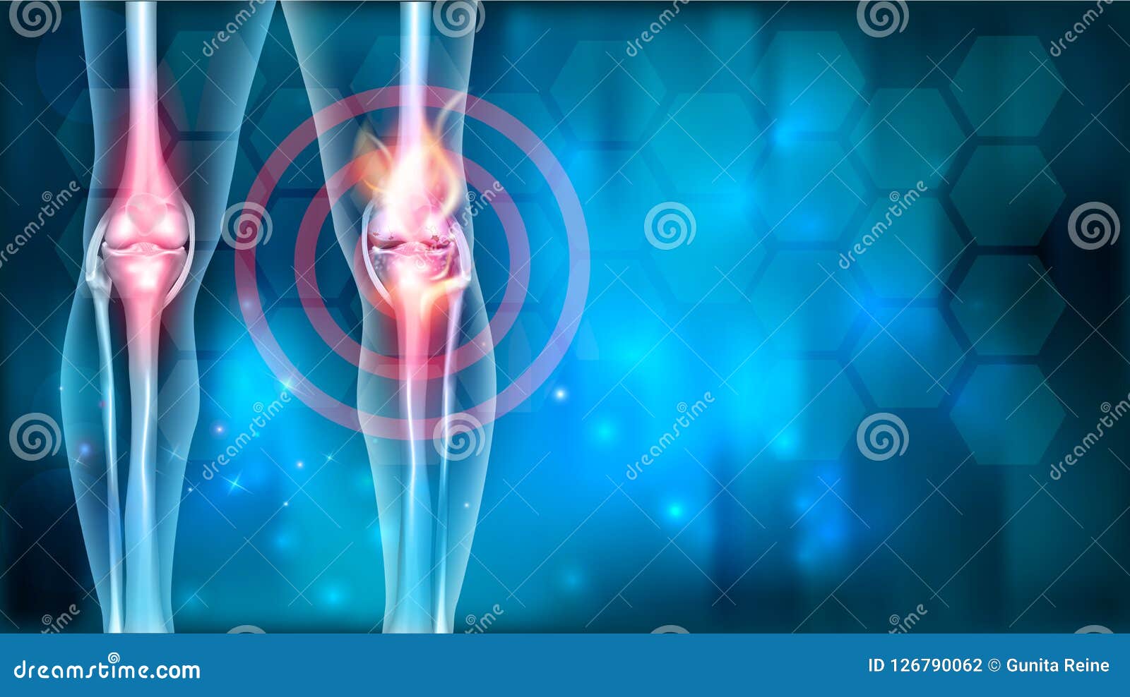 Joint ache problems stock vector. Illustration of arthritis - 126790062