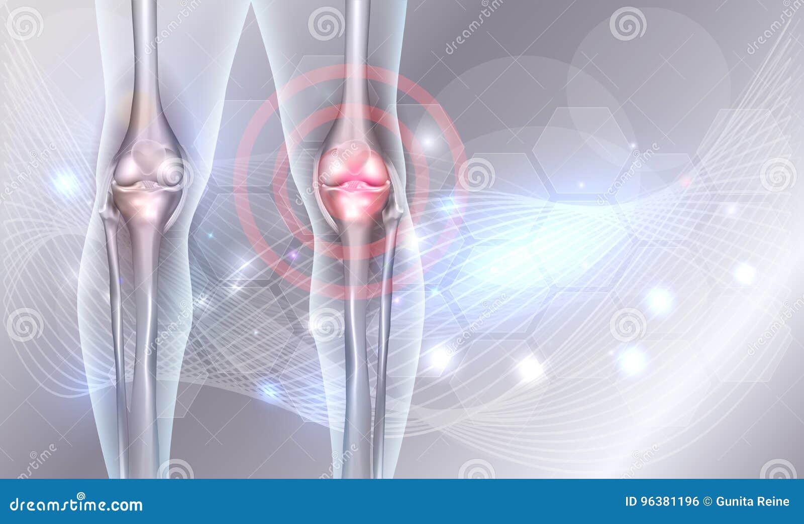 Joint background stock vector. Illustration of disorder - 96381196