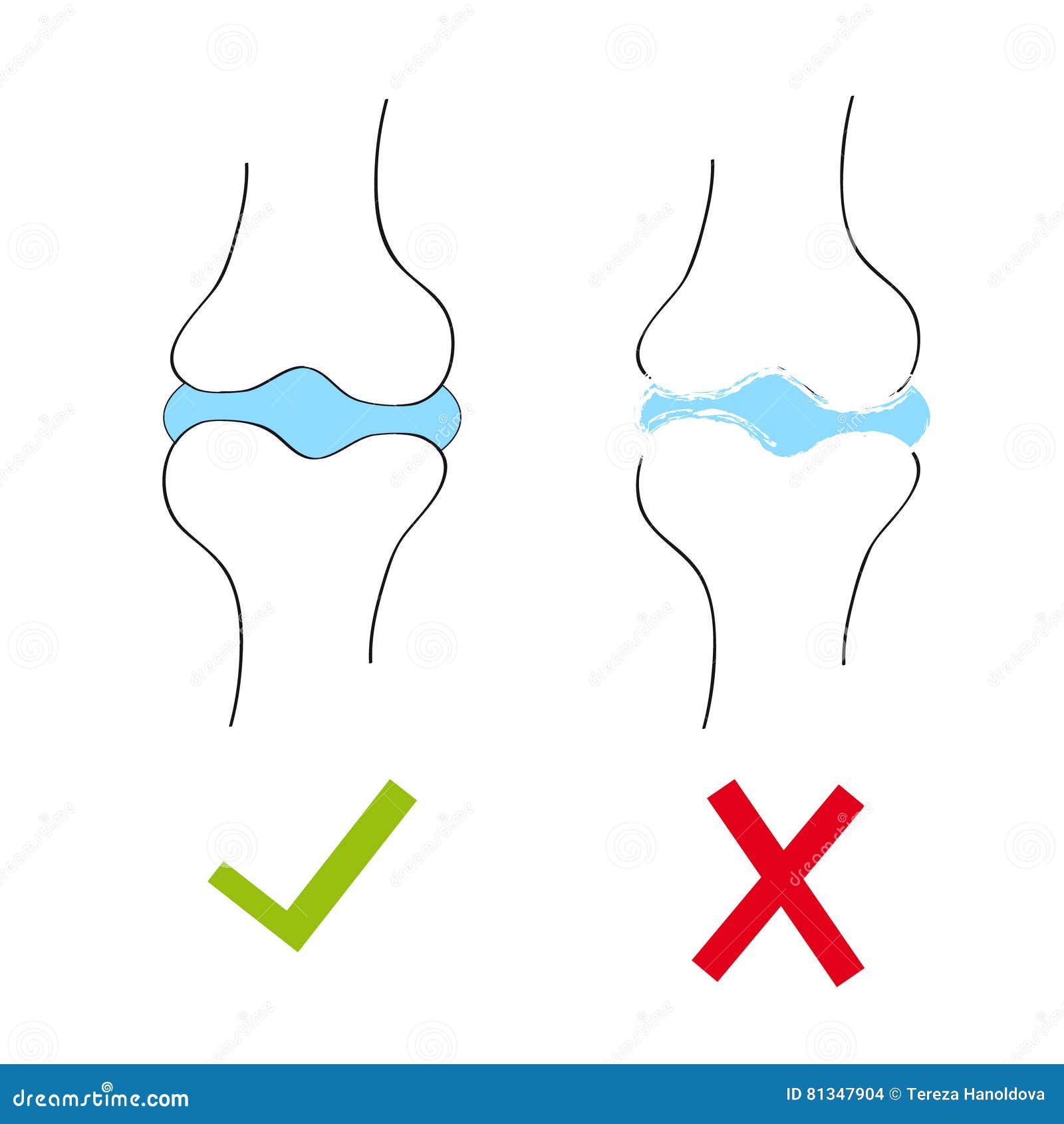 Cartilage Cartoons, Illustrations & Vector Stock Images - 2408 Pictures ...
