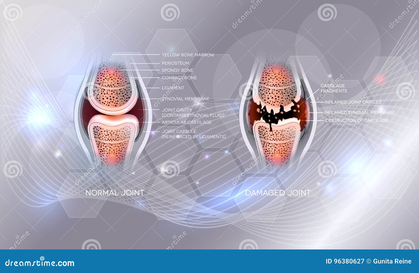 Joint stock vector. Illustration of education, joint - 96380627