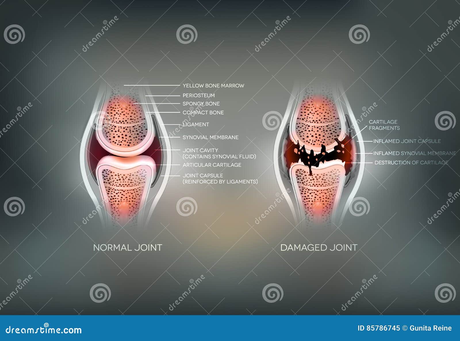 Normal Synovial Joint Anatomy Vector Illustration | CartoonDealer.com ...