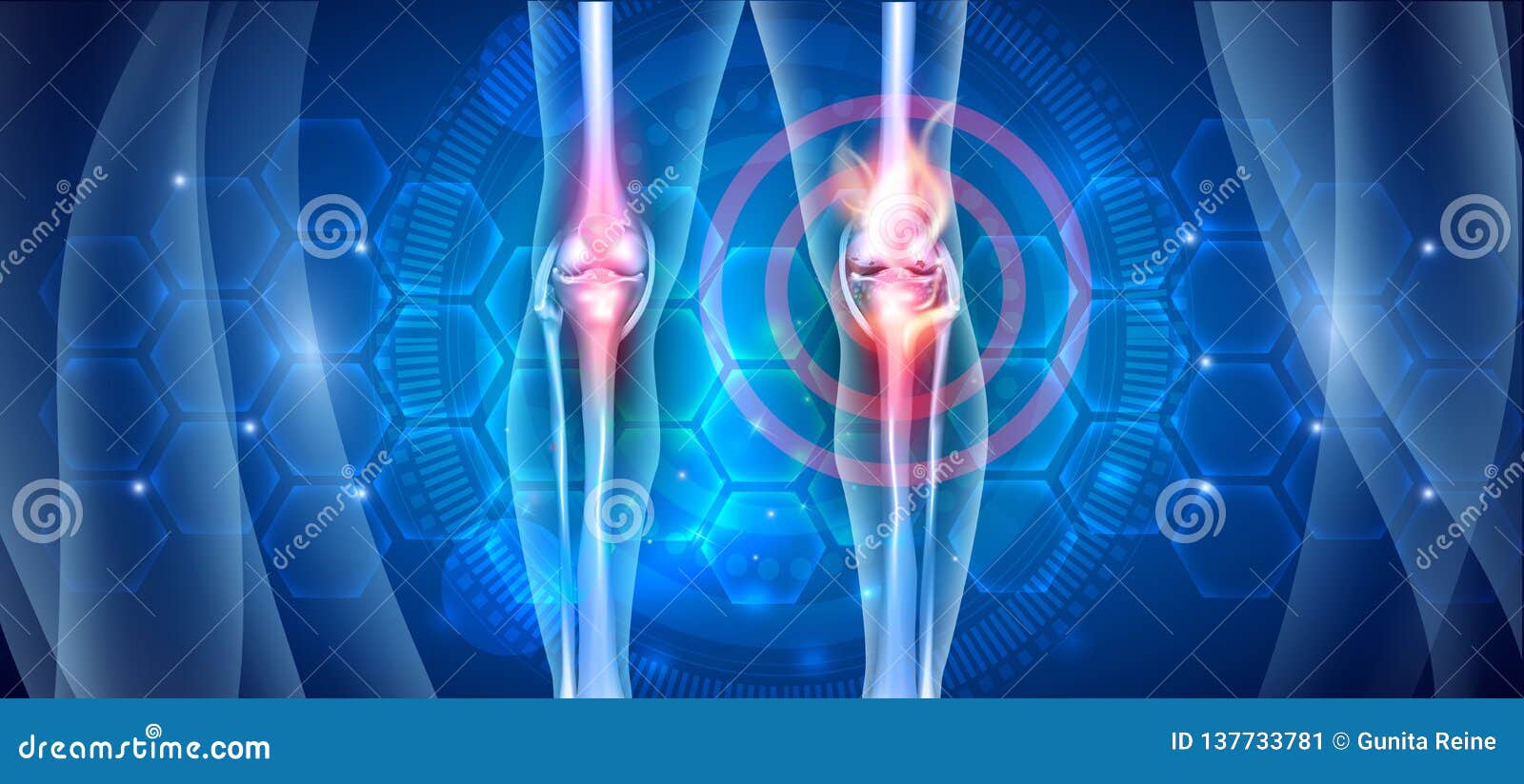 Joint Knee Problems Abstract Diagram Stock Vector - Illustration of ...