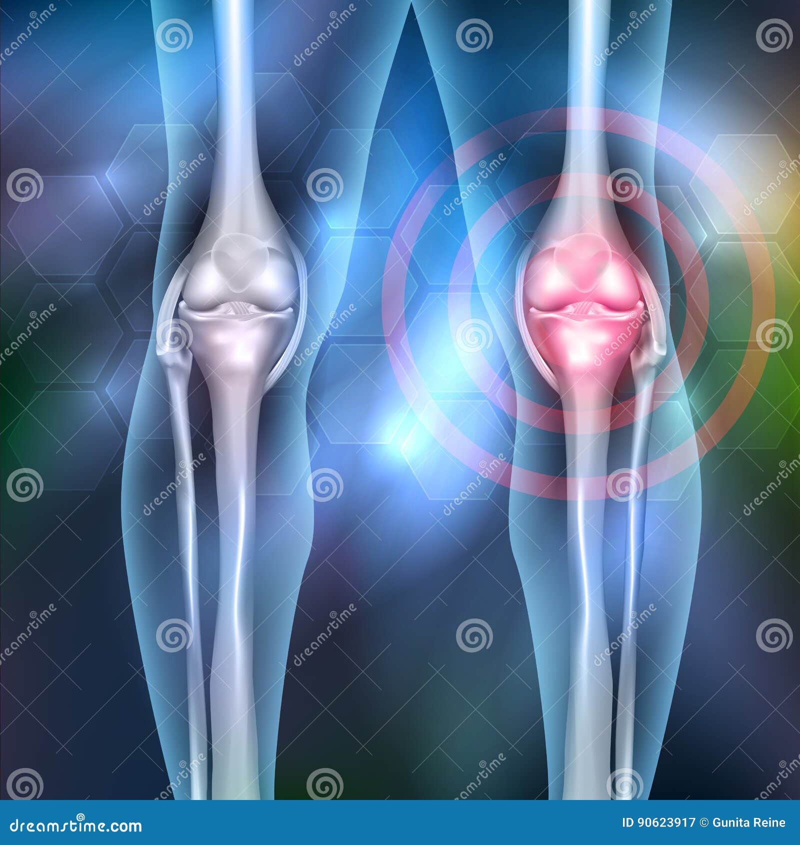 Joint pain stock vector. Illustration of disorder, disease - 90623917