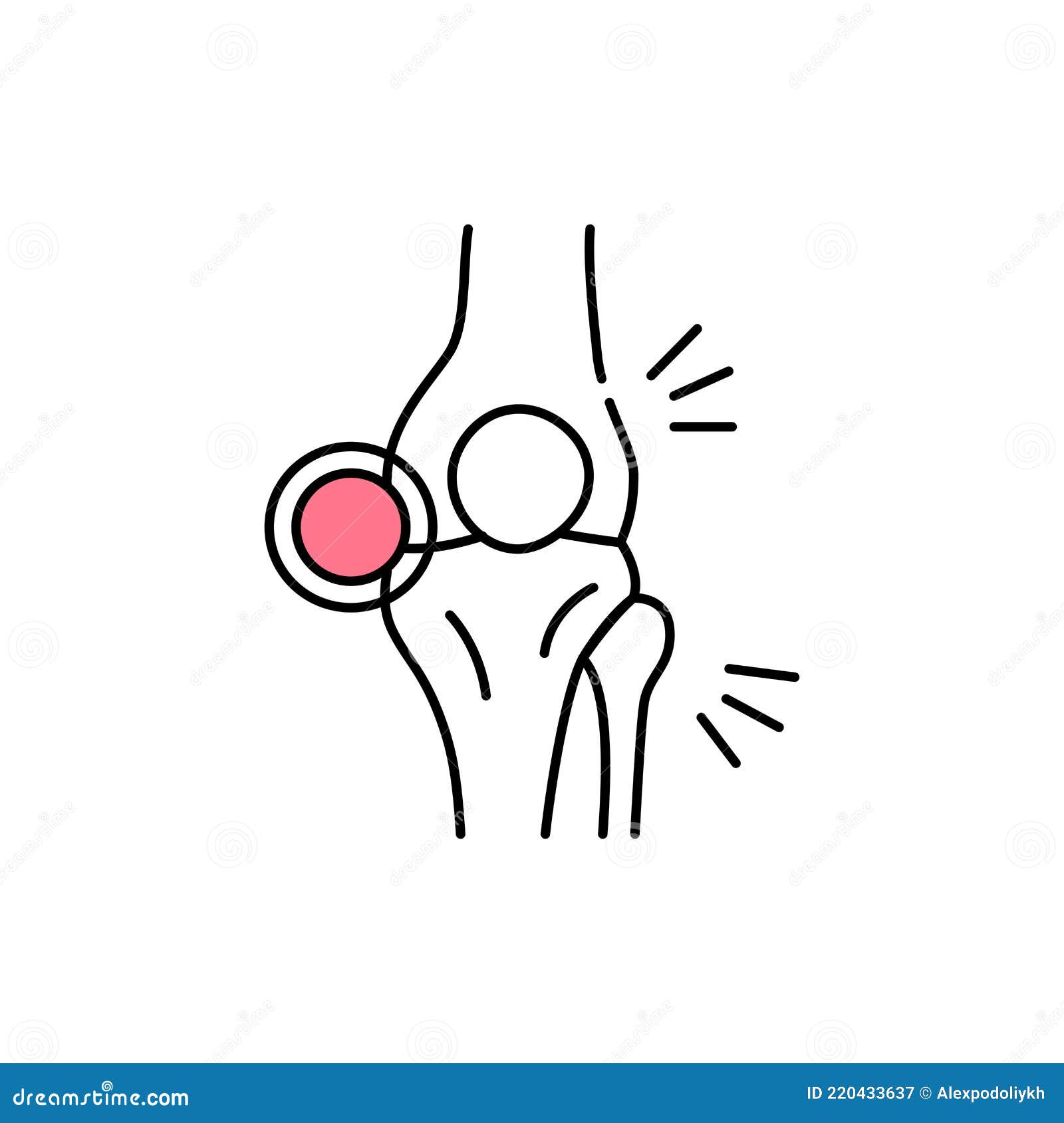 Hip Joint Problem_Pincer Femoroacetabular Impingement With Section ...