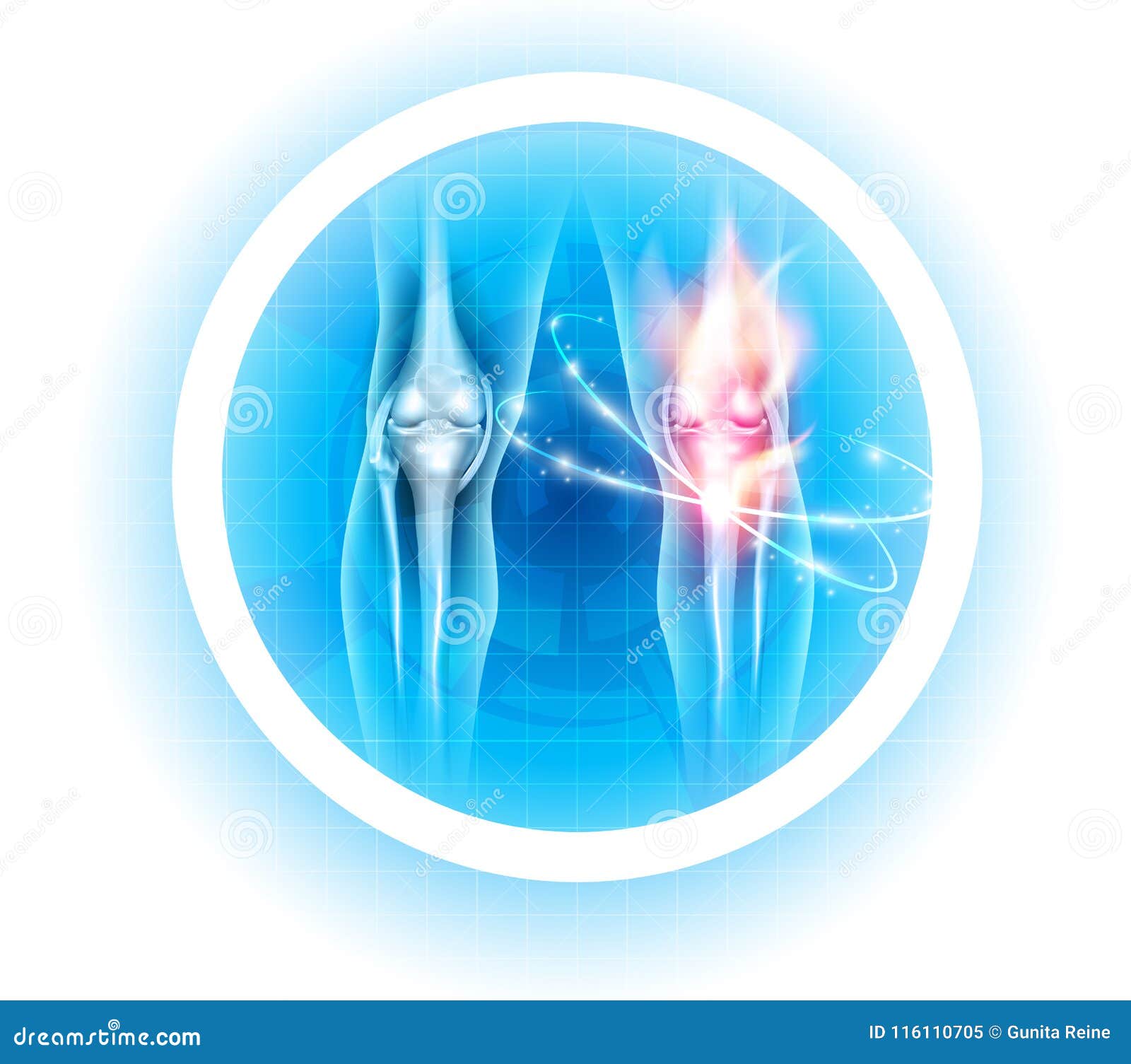 Joint problems symbol stock vector. Illustration of ache - 116110705